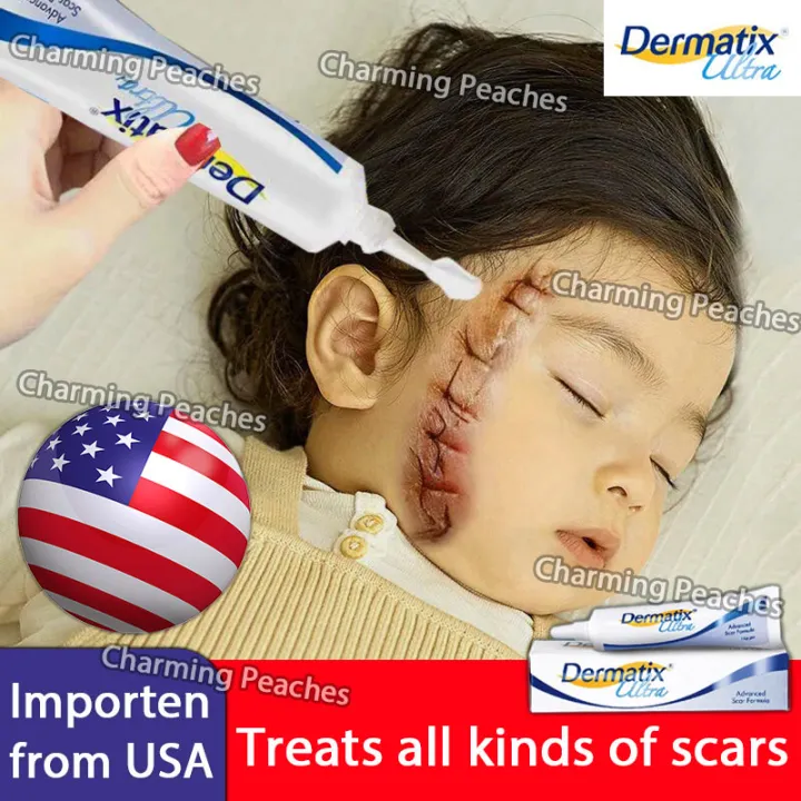 【US imports】Dermatix Ultra Advanced Scar Formula Acne Scar Removal ...