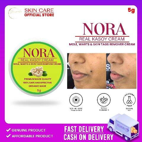 MOLE REMOVER【NORA Real Kasoy Cream】 mole remover , mole remover organic ...