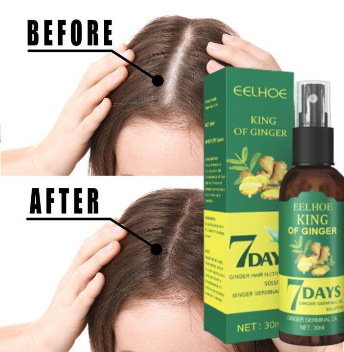🔥Attraction🔥Ginger Spray Anti Hair Loss Hair Care Essence Repairing ...