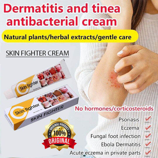 Skin Fighter Cream for Skin Allergies or Fungis 8g 15g | Lazada PH