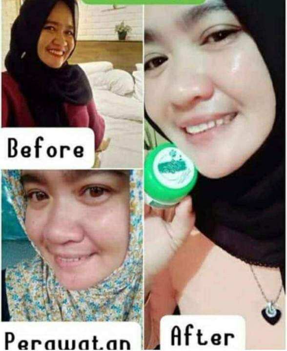 Viral Cream 2in1 RD'n Ijo Original | Lazada Indonesia
