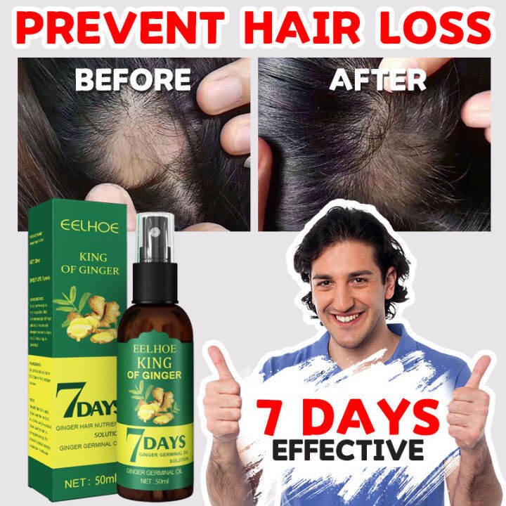 Eelhoe 7 Day Hair Nutrition Spray Hair Growth And Prevents Hair Loss ...