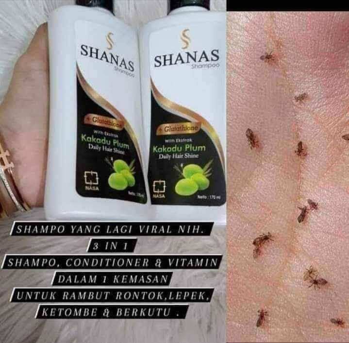 SHAMPO PERONTOK KUTU DAN KETOMBE PALING AMPUH - ATAS KERONTOKAN RAMBUT ...