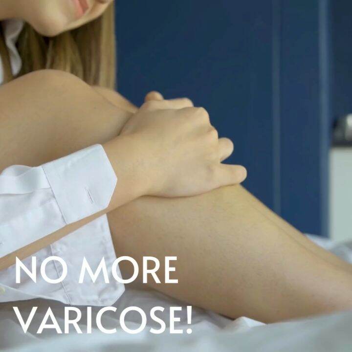 Varicare Serum 30 mL - Natural Vein Remover - Anti-Varicose Vein ...