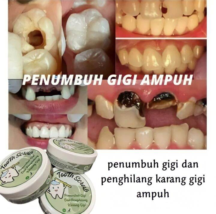 SCRUB TOOTH PENUMBUH GIGI OMPONG AMPUH 7x PEMAKAIAN | Lazada Indonesia