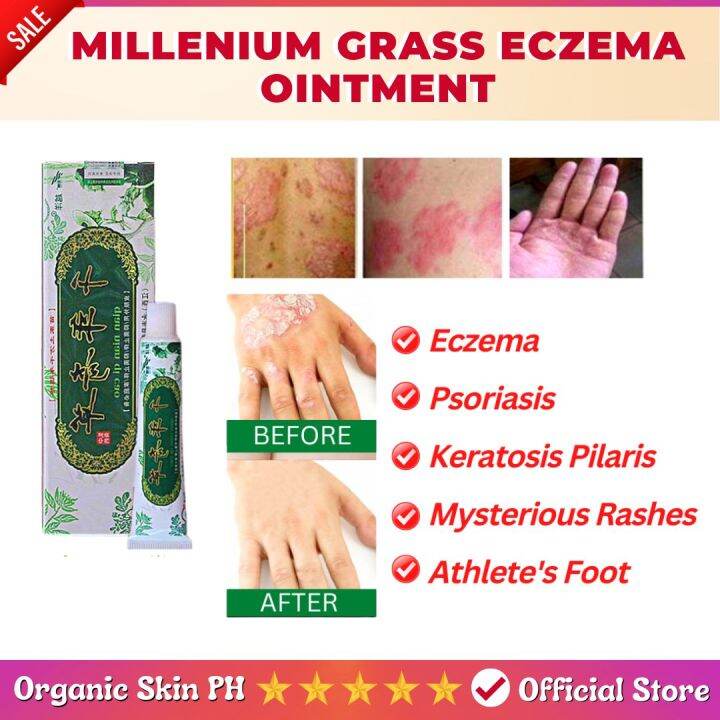 Millennium Grass Herbal Ointment: Traditional Medicine Cream for Eczema, Psoriasis, Dermatitis ...