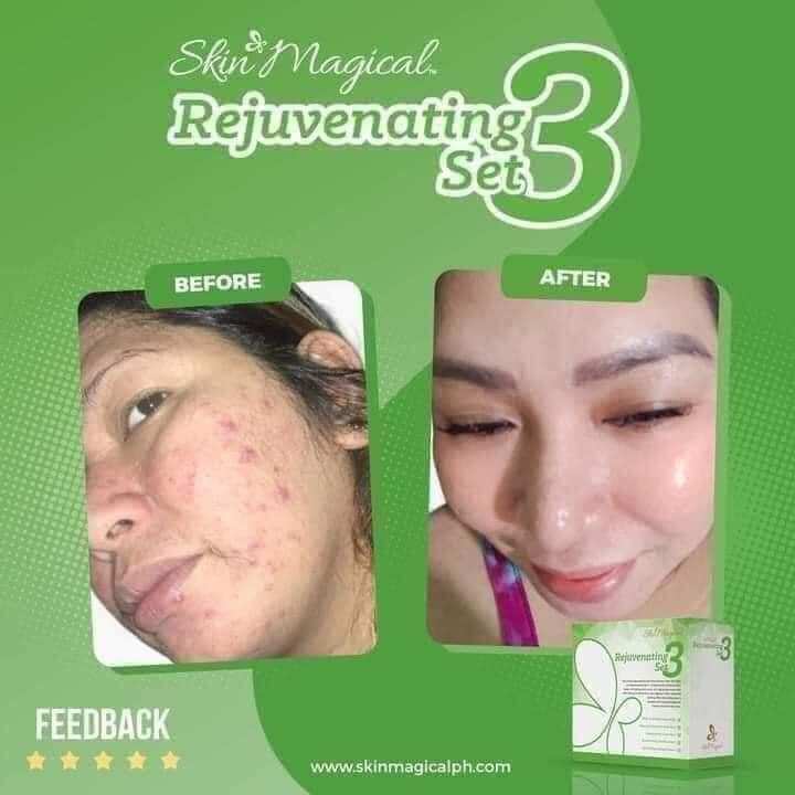 Skin Magical Set 3 | Lazada PH