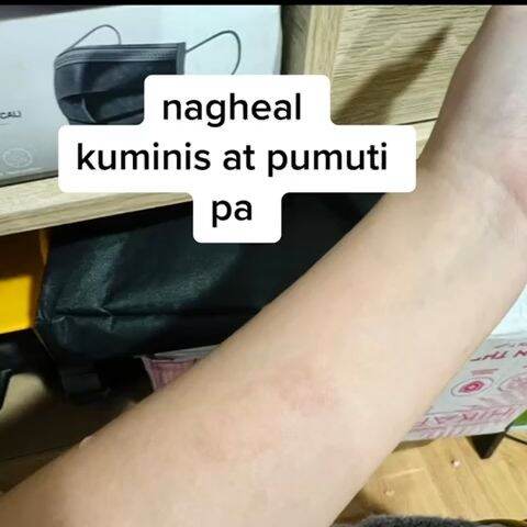 Gamot sa Kati Kati sa Balat Himalayan Soap Whitening Glutathione for ...