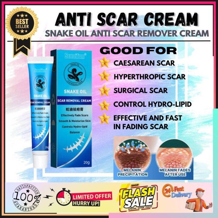 💯 SUMIFUN SCAR SNAKE OIL CREAM REMOVER Scar Cream Peklat Remover Acne ...