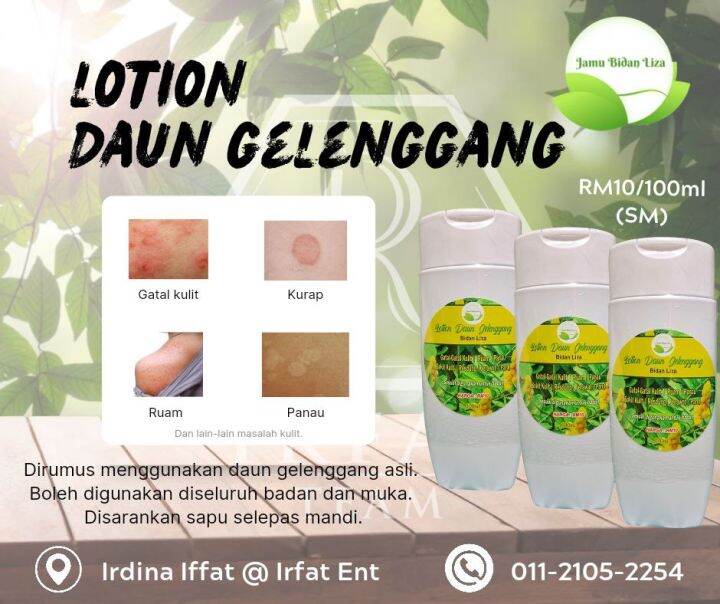 Lotion Daun Gelenggang (Kulit Gatal) | Lazada