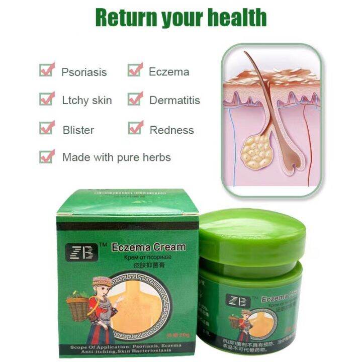 Zb 20g Antibacterial Skin Psoriasis Cream Dermatitis Eczematoid Eczema