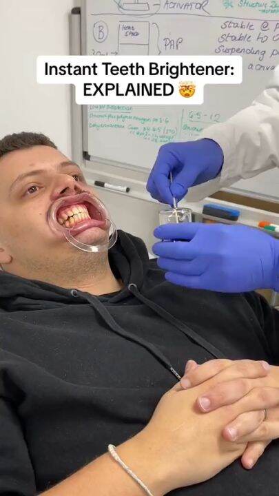 Smile Ease TOOTHPASTE V34 teeth whitening colour corrector stain ...