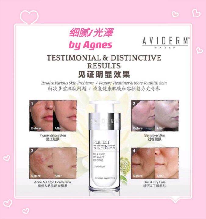 Aviderm Perfect Refiner 30ml 细化毛孔ex date 2026 | Lazada