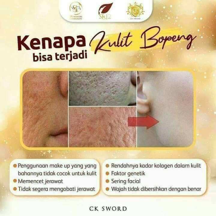 Serum penghilang bopeng 20 ml | Lazada Indonesia