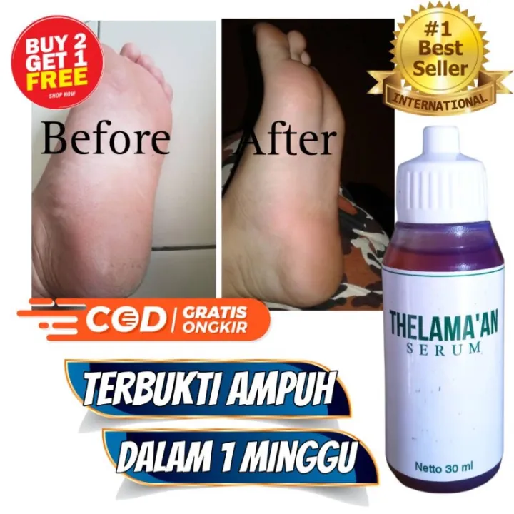 obat kaki ORIGINAL THELAMA'AN SERUM obat kaki pecah pecah dan kapalan ...