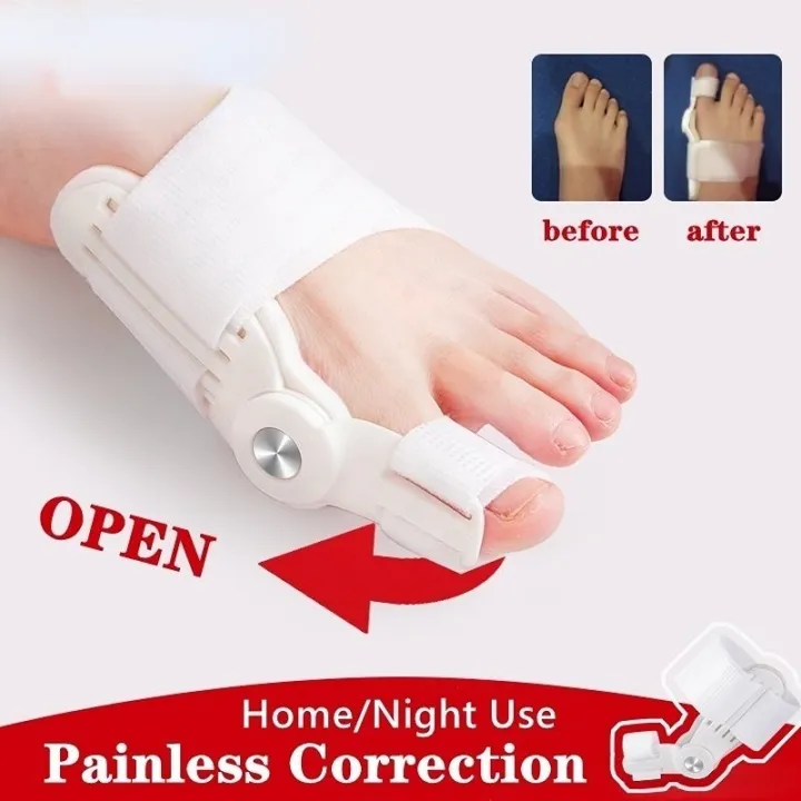 1 PC Big Toe Bunion Device Splint Straightener Corrector Foot Hallux ...