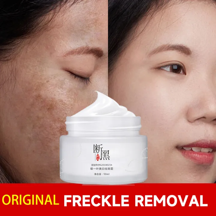 Fast effective freckle removal whitening cream with vitamin c ...