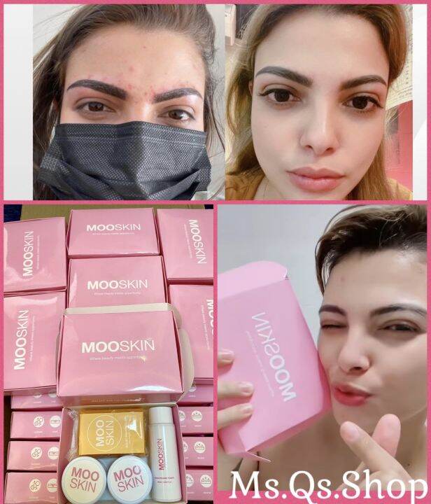 MOOSKIN SKIN RENEWAL SET | Lazada PH