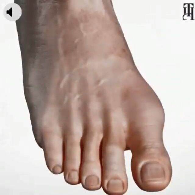 Original Gout Ointment Cream Pain Relief for Joint Knee pain, Arthritis ...