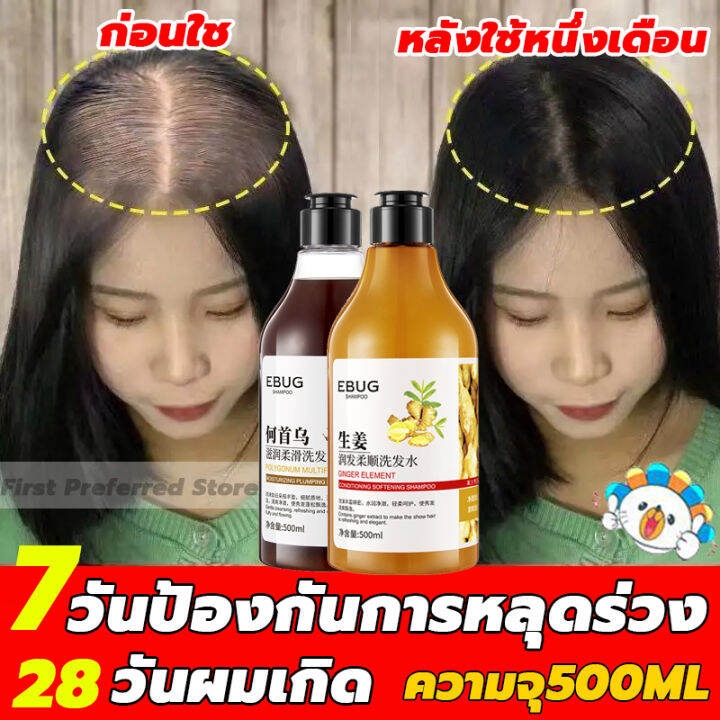 EBUGยาสระผมแก้ร่วง500ml แชมพูลดผมร่วงขิงช่วยป้องกันผมร่วงผมยาวไว แชมพู ...
