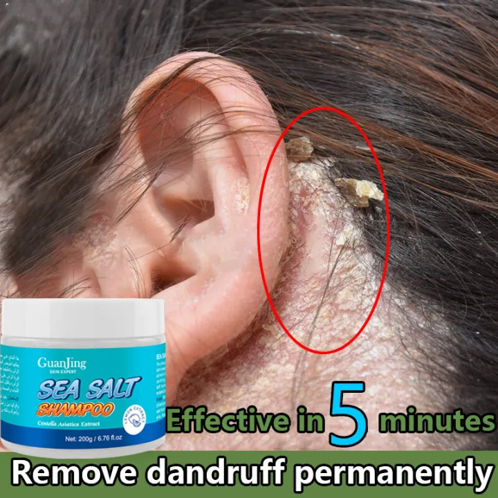 Sea Salt Shampoo Anti-Dandruff Refreshing Oil Control Deep Scalp ...