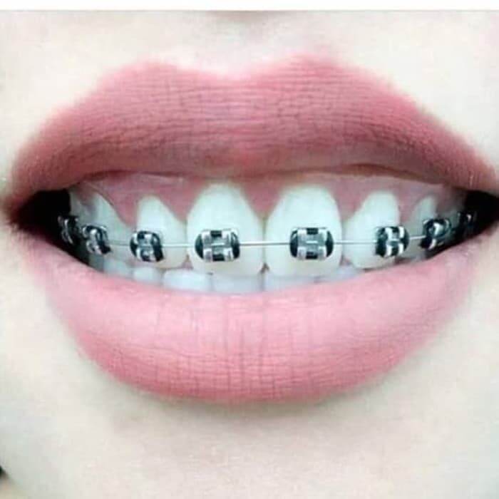 [ TERLARIS!! ] Behel Fashion Original Hitam Atas Atau Bawah Saja FREE ...