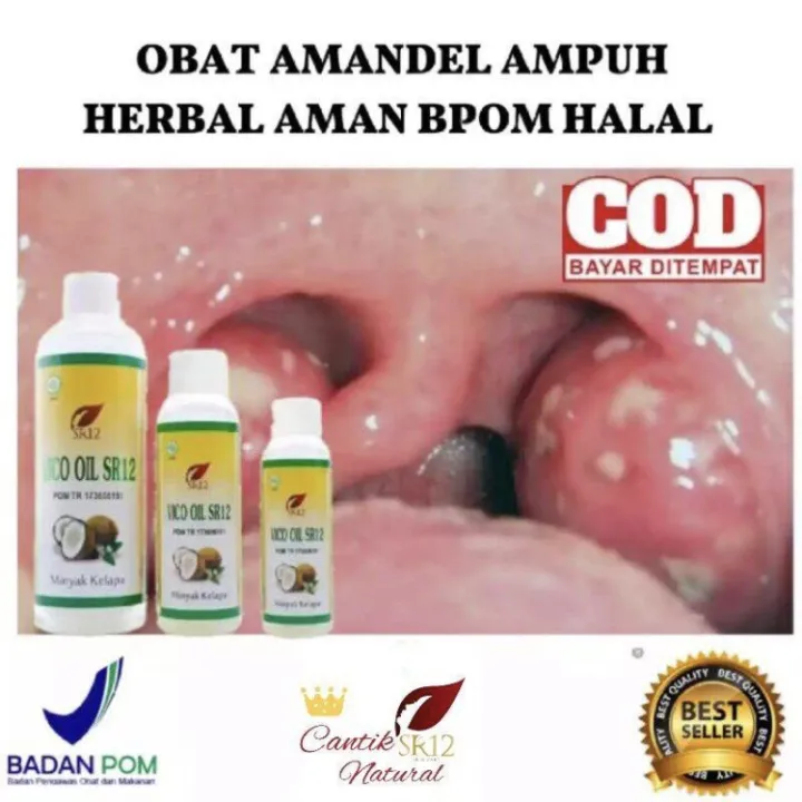 OBAT AMANDEL HERBAL ALAMI BPOM / VICO SR12 / OBATI AMANDEL YANG ...