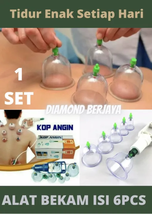 [BISA COD] Kop Angin Bekam Kongsui Lengkap 6 Pcs Mengobati Berbagai Macam Penyakit dan Therapy ...
