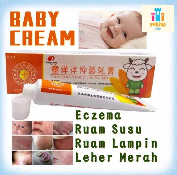 SMILING- 童洋洋 Baby Antibacterial Cream Ezcema Redness Ruam Susu Ruam ...