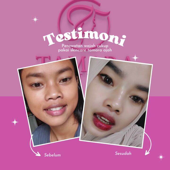 Tamara Beauty Skin Edisi Satuan/item | Lazada Indonesia