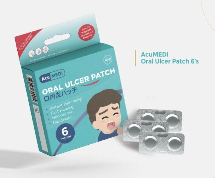 READYSTOK ORAL ULSER PATCH | Lazada