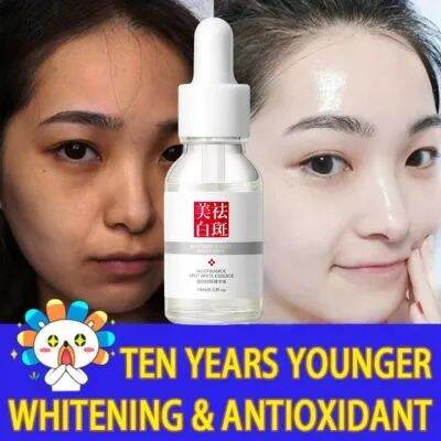 Whitening Freckle Serum Remove Dark Spots Anti Freckle Cream ...