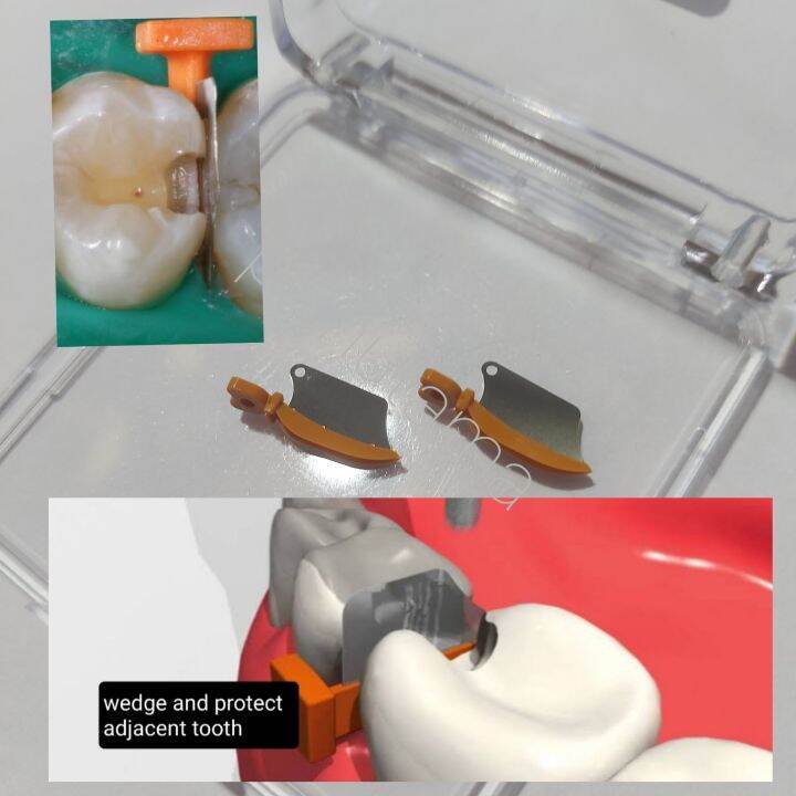 dental interproximal tooth shield dental wedge with protector for ...