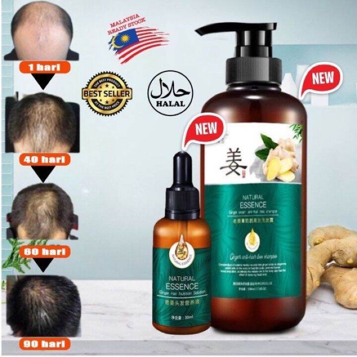 zhenxiu Ginger,sampo anti ketombe dan rontok parah. | Lazada Indonesia