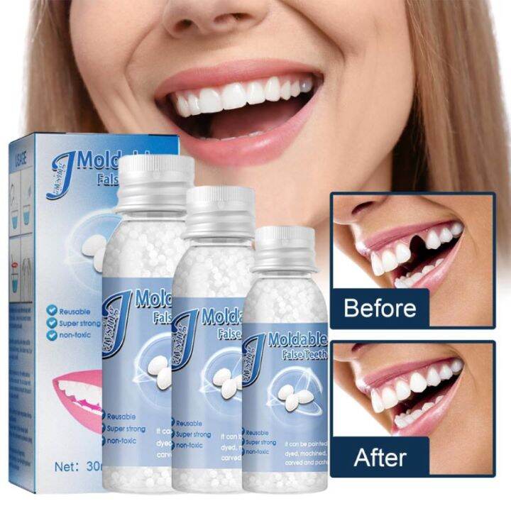【Fast filling】Temporary Tooth Repair Kit Teeth and Gaps Moldable ...