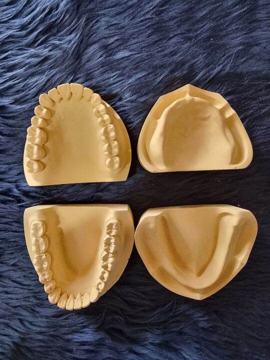 Dentolous and Edentulous Cast Model | Lazada PH