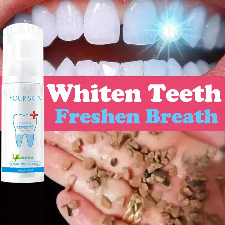 【COD】Teeth Whitening Mousse Toothpaste Oral Hygiene Remove Stains ...