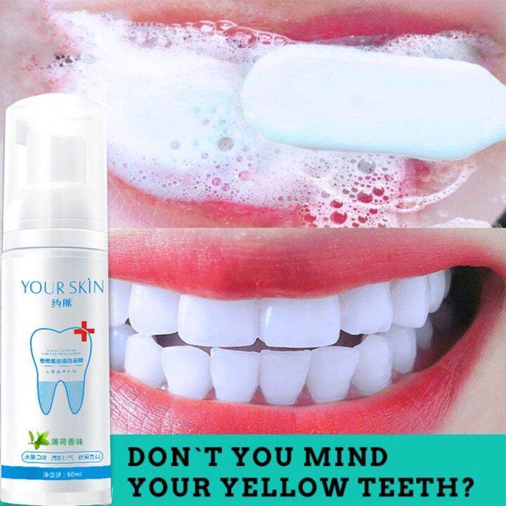 Teeth Whitening Mousse Cleansing teeth Mousse Remove Tartar Remove ...