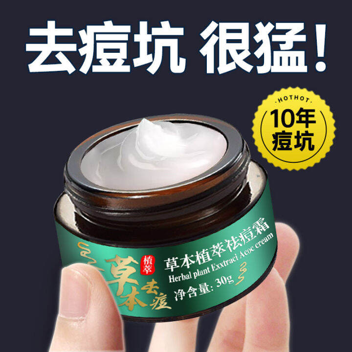 Remove Acne Marks Pox Pits Acne Cream Remove Red and Swollen Acne Pox ...