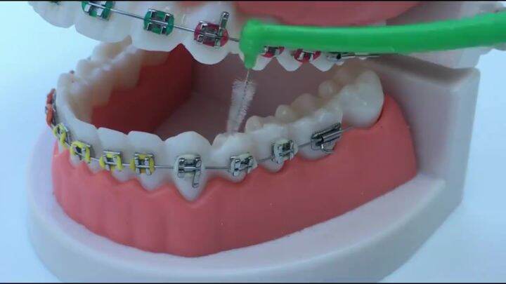 20Pcs Sikat Sela Behel Gigi Interdental Brush Bengkok Bentuk L Sikat ...