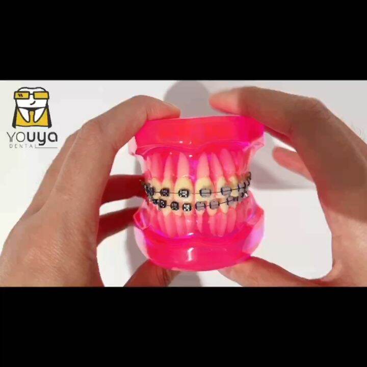 Dentistry Orthodontic Model Typodont Half Metal Half Ceramic Ortho ... Dentistry Orthodontic Model Typodont Half Metal Half Ceramic Ortho ...