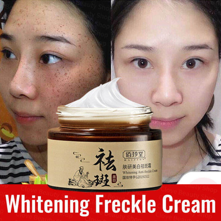 30g Whitening melasma cream Freckle Removing Cream pekas cream original ...