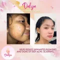 ON HAND Dalya Soap x5 whitening by Niel Padilla | Lazada PH