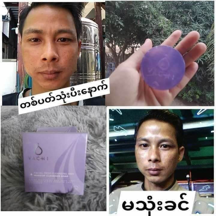 ပ်ိဳတိုင္းႀကိဳက္တဲ့ လ်ိဳ့ဝွက္ခ်က္က Vachi soapမွာရွိပါတယ္ Vachi soapနဲ ...