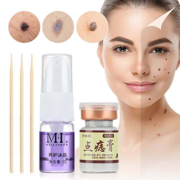 Mole Remover Cream Set Fat Particles Warts Skin tag removal Serum No ...