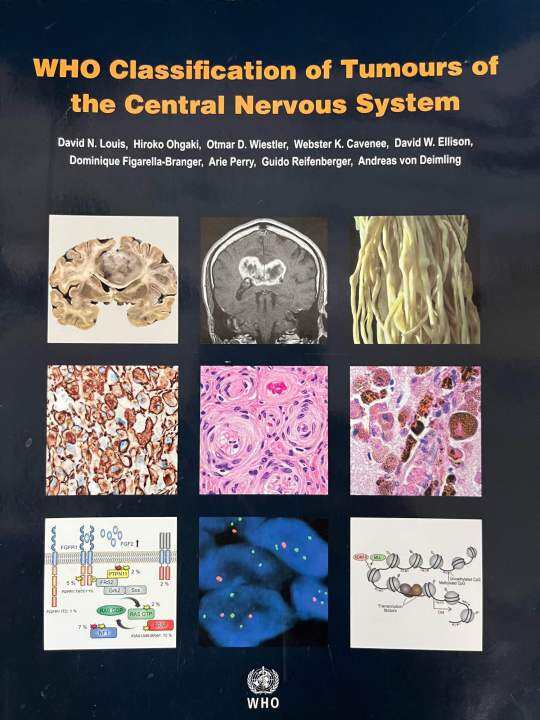 WHO Classification of Tumours of the Central Nervous System | Lazada