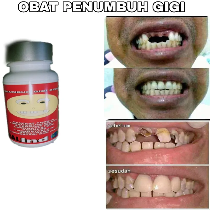 VITAMIN PENUMBUH GIGI DEWASA | Lazada Indonesia