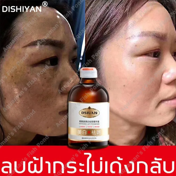 DSIUAN ไวท์ครีม ลดฝ้ากระและให้ผิวขาวกระจ่างใส ใช้ลดฝ้ากระได้ทุกชนิด ลด ...