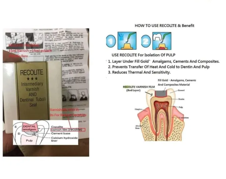 RECOLITE INTERMEDIARY VARNISH AND DENTAL TUBULI SEAL | Lazada PH