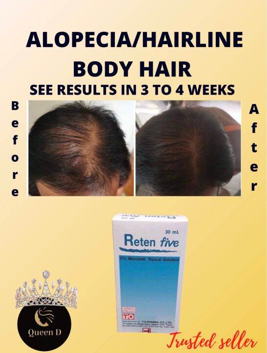 Reten Five 1box Lazada Ph
